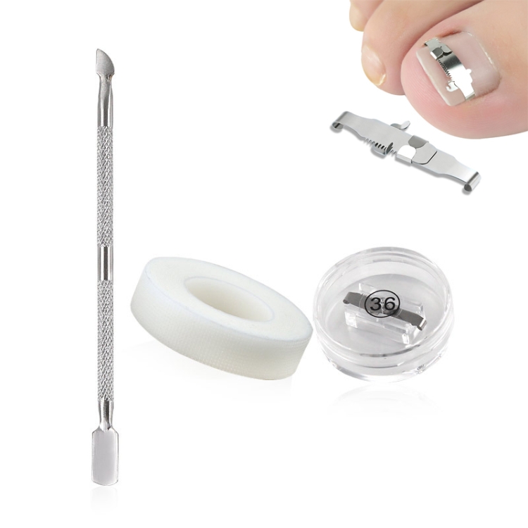 Orthopedic Buckle Toe Nail Groove Ingrown Nail Corrector, Style:No. 44 ...