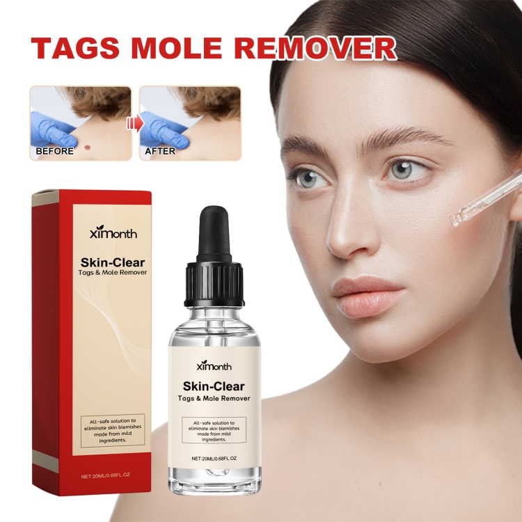EELHOE 30ml/Bottle Anti Mole And Wart Liquid Dark Spot Tag Remover Skin ...