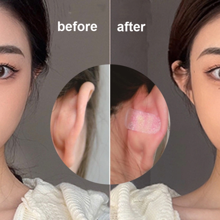 150 PCS Elf Ear Stickers Ear Correction Vertical Ear Stickers ...