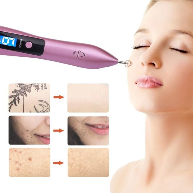 9 Gears Mole Spotting Pen LCD Home Laser Mole Spot Sweeping Beauty ...