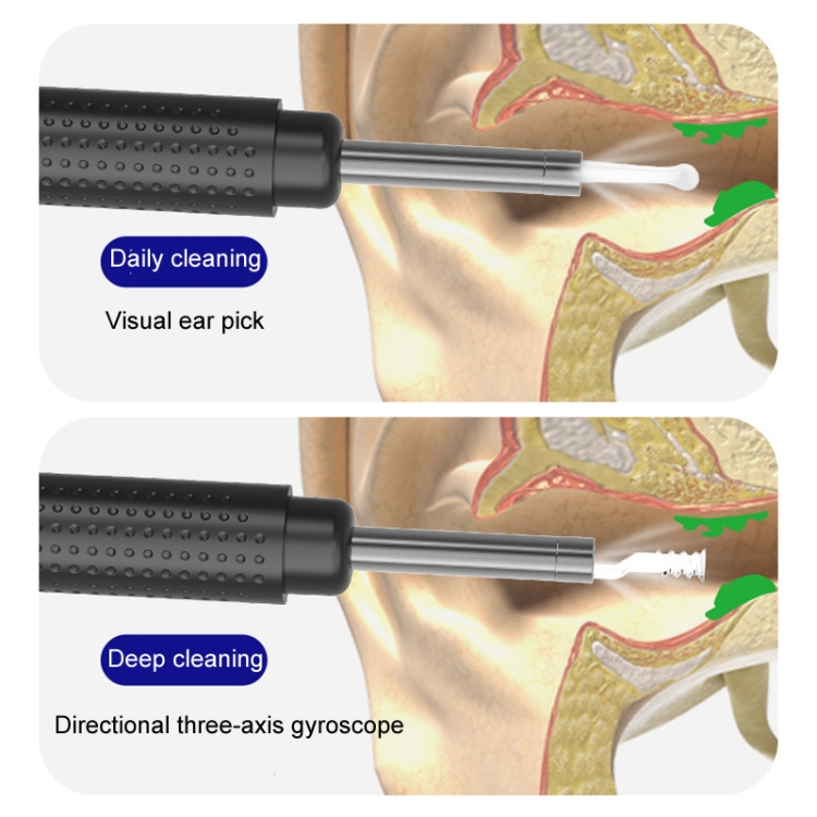 Household Visual Ear Excavator High-Definition Ear Wax Removal Picking ...